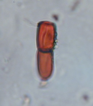 European Bison, Rewilding and Dung Fungal Spore – Methods Blog